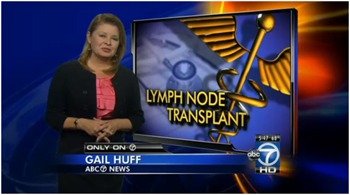 Regions First Lymph Node Transplant at Inova Featured on ABC7 - Inova ...