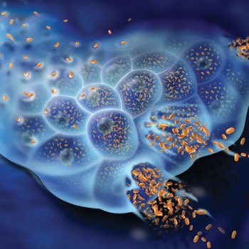 Cold Sore Virus as Melanoma Treatment - Inova Newsroom